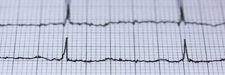 Angioplasty, Stents, and Statins | Healthy Lifestyle